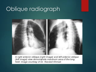 READING CHEST X RAY : MAKING DIAGNOSIS EASIER | PPTX