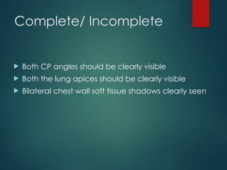 READING CHEST X RAY : MAKING DIAGNOSIS EASIER | PPT
