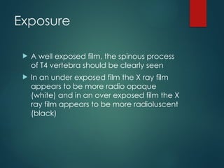 READING CHEST X RAY : MAKING DIAGNOSIS EASIER | PPT