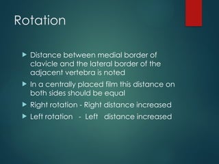 READING CHEST X RAY : MAKING DIAGNOSIS EASIER | PPT