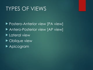 READING CHEST X RAY : MAKING DIAGNOSIS EASIER | PPT