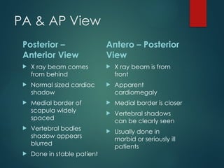 READING CHEST X RAY : MAKING DIAGNOSIS EASIER | PPT