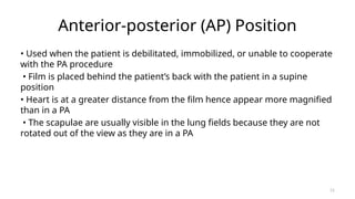 CHEST XRAY normal anatomy and pathology.pptx