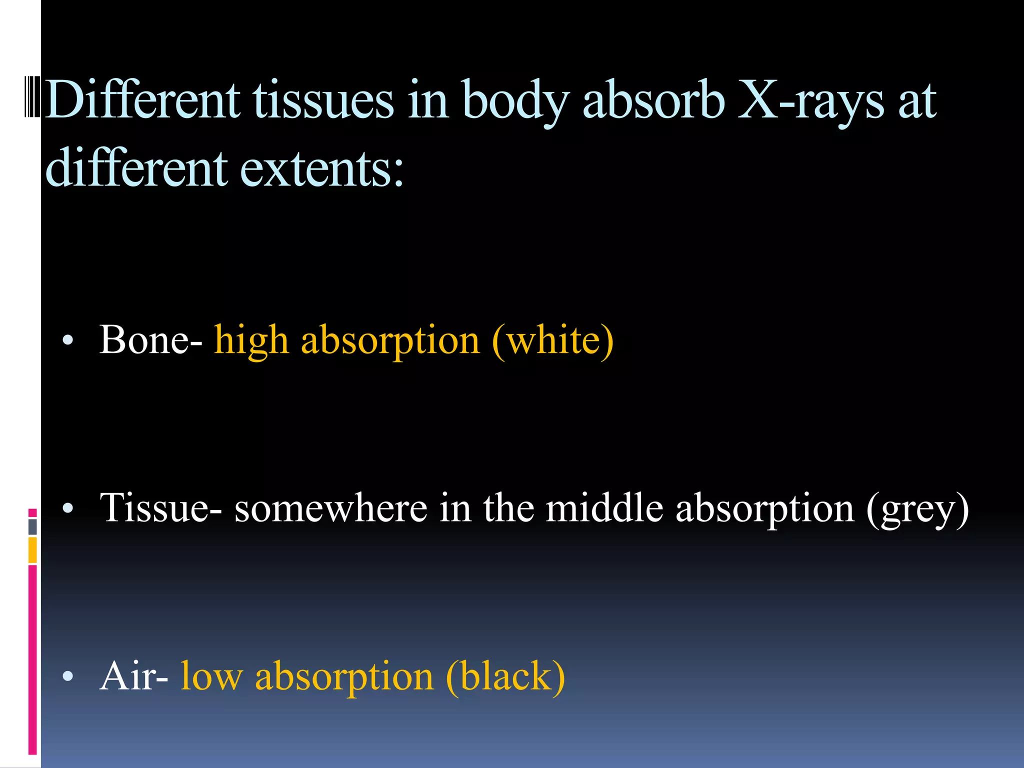 Chest xray | PPTX
