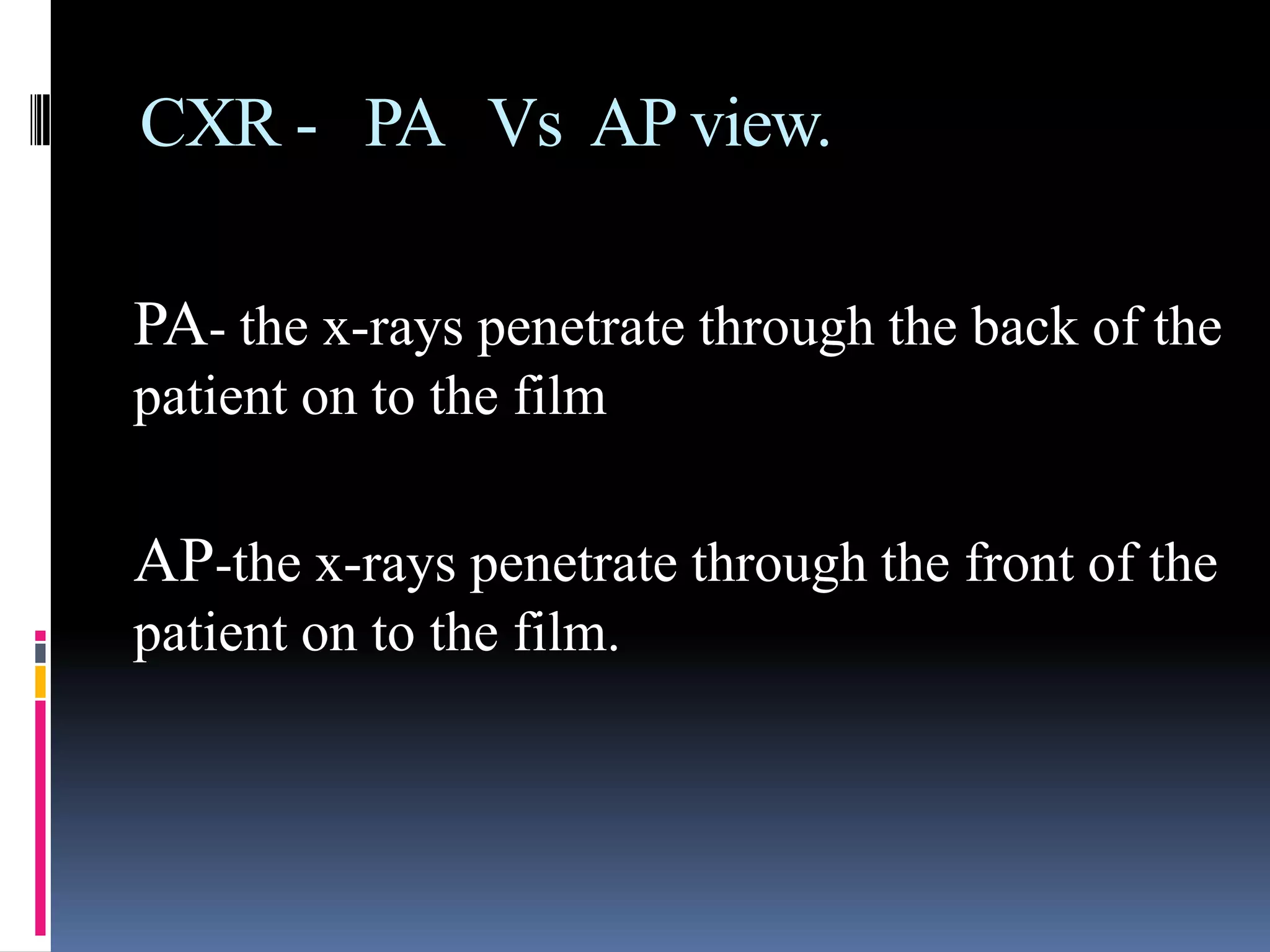 Chest xray | PPTX