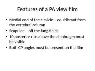 Chest X ray ap and pa view , findings in various diseases | PPTX