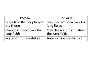 Chest X ray ap and pa view , findings in various diseases | PPTX