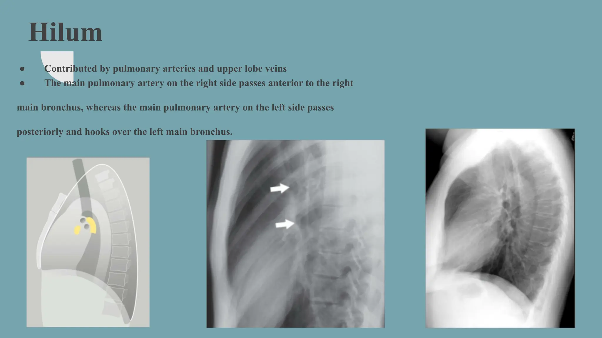 Chest xray -Lateral view radiology basics | PDF