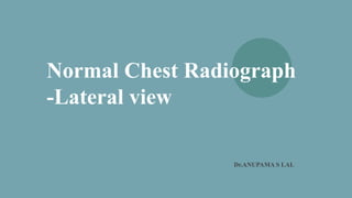 Chest xray -Lateral view radiology basics | PDF