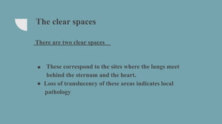Chest xray -Lateral view radiology basics | PDF
