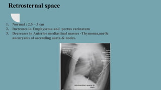 Chest xray -Lateral view radiology basics | PDF