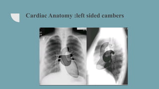 Chest xray -Lateral view radiology basics | PDF