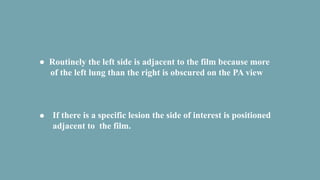 Chest xray -Lateral view radiology basics | PDF