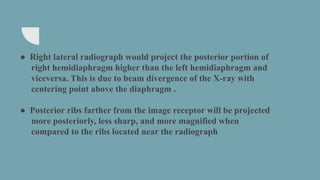 Chest xray -Lateral view radiology basics | PDF