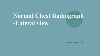 Chest xray -Lateral view shows major anatomical structure in ...