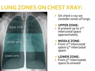 chest x ray 2.pptx