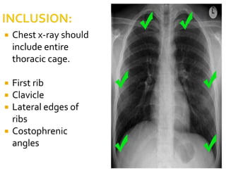 chest x ray 2.pptx