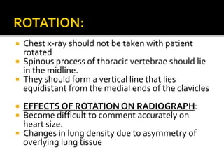 chest x ray 2.pptx