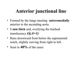 Chest XRay and other imaging investigations of chest, CT chest, HRCT ...