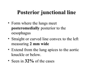 Chest XRay and other imaging investigations of chest, CT chest, HRCT ...