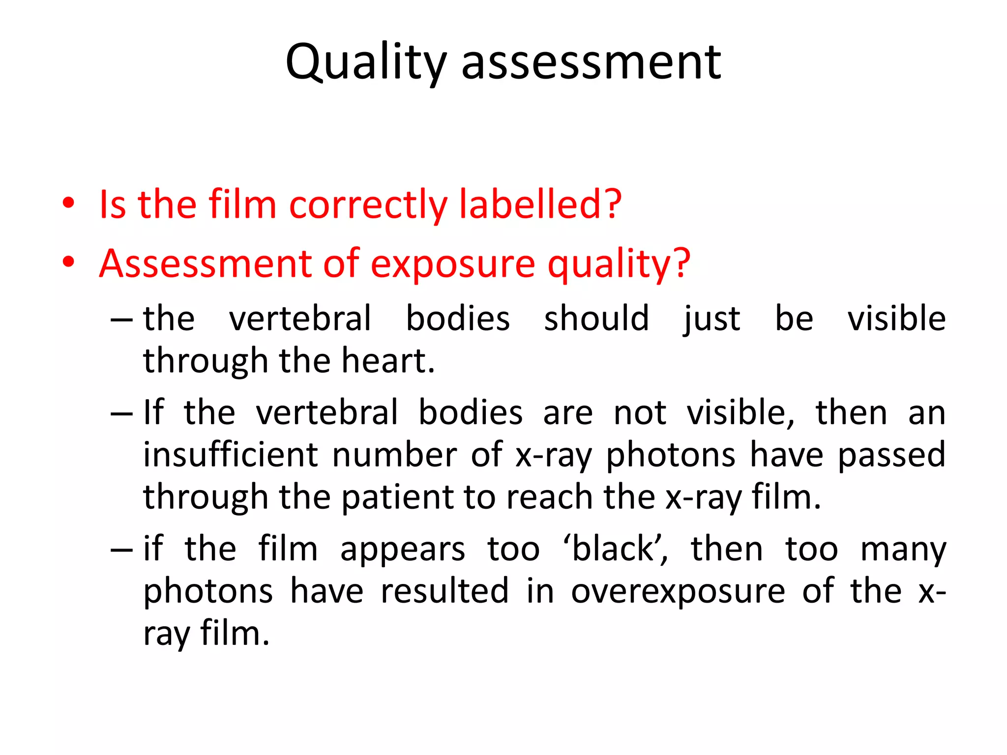 Chest x ray basic | PDF