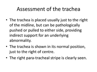 Chest x ray basic | PDF