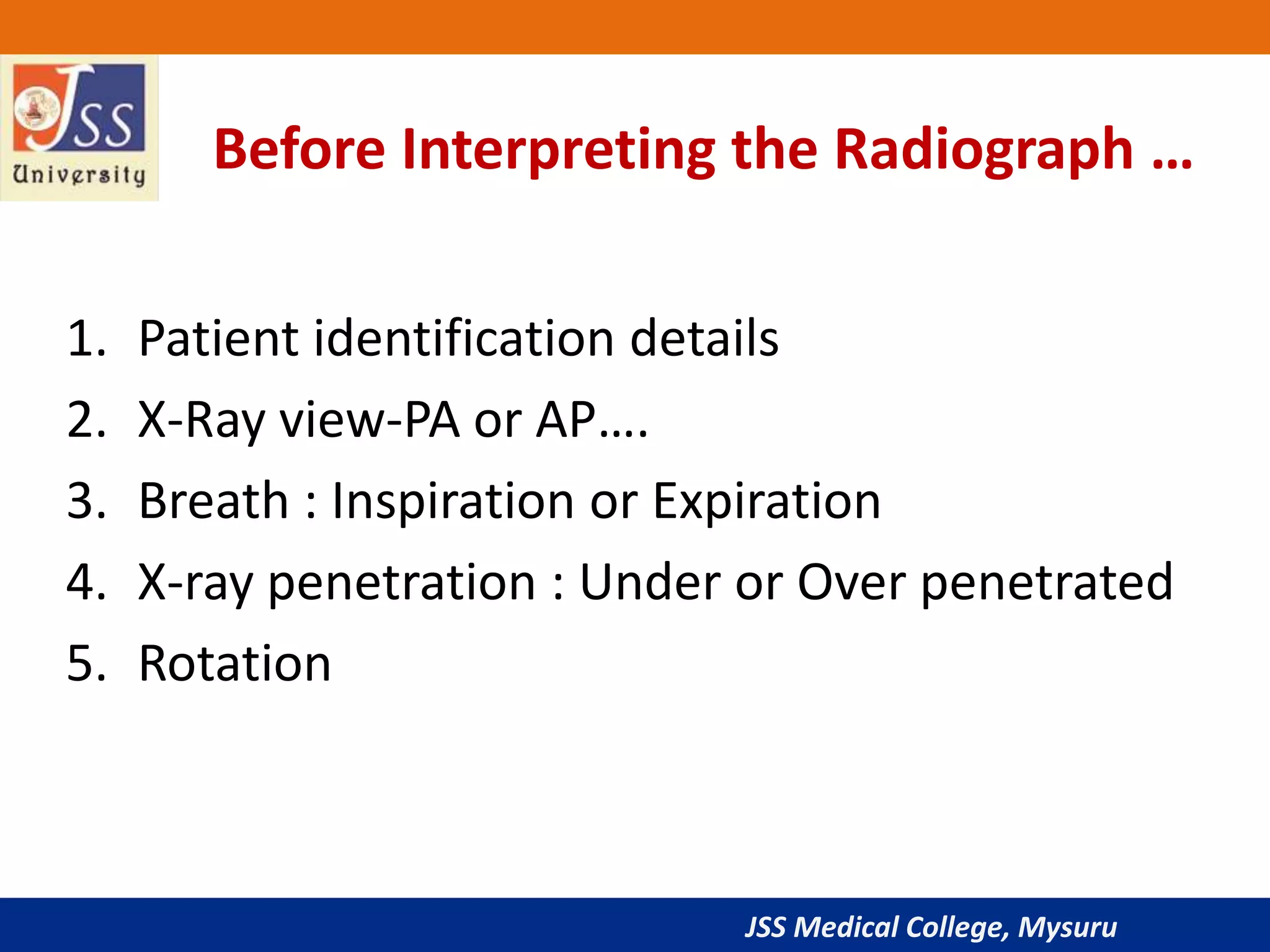 Chest x ray basic interpretation | PPTX