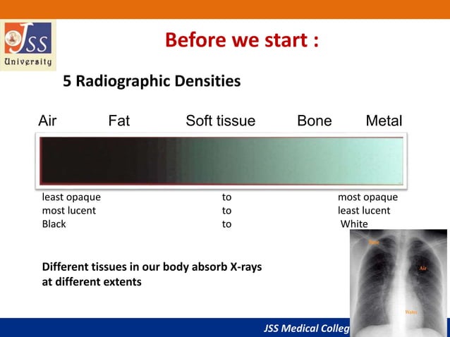 Chest x ray basic interpretation | PPTX