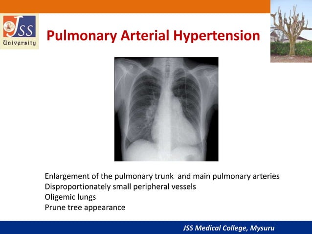 Chest x ray basic interpretation | PPTX