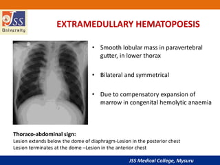Chest x ray basic interpretation | PPTX