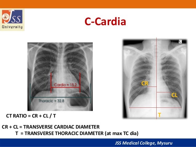 Chest x ray basic interpretation