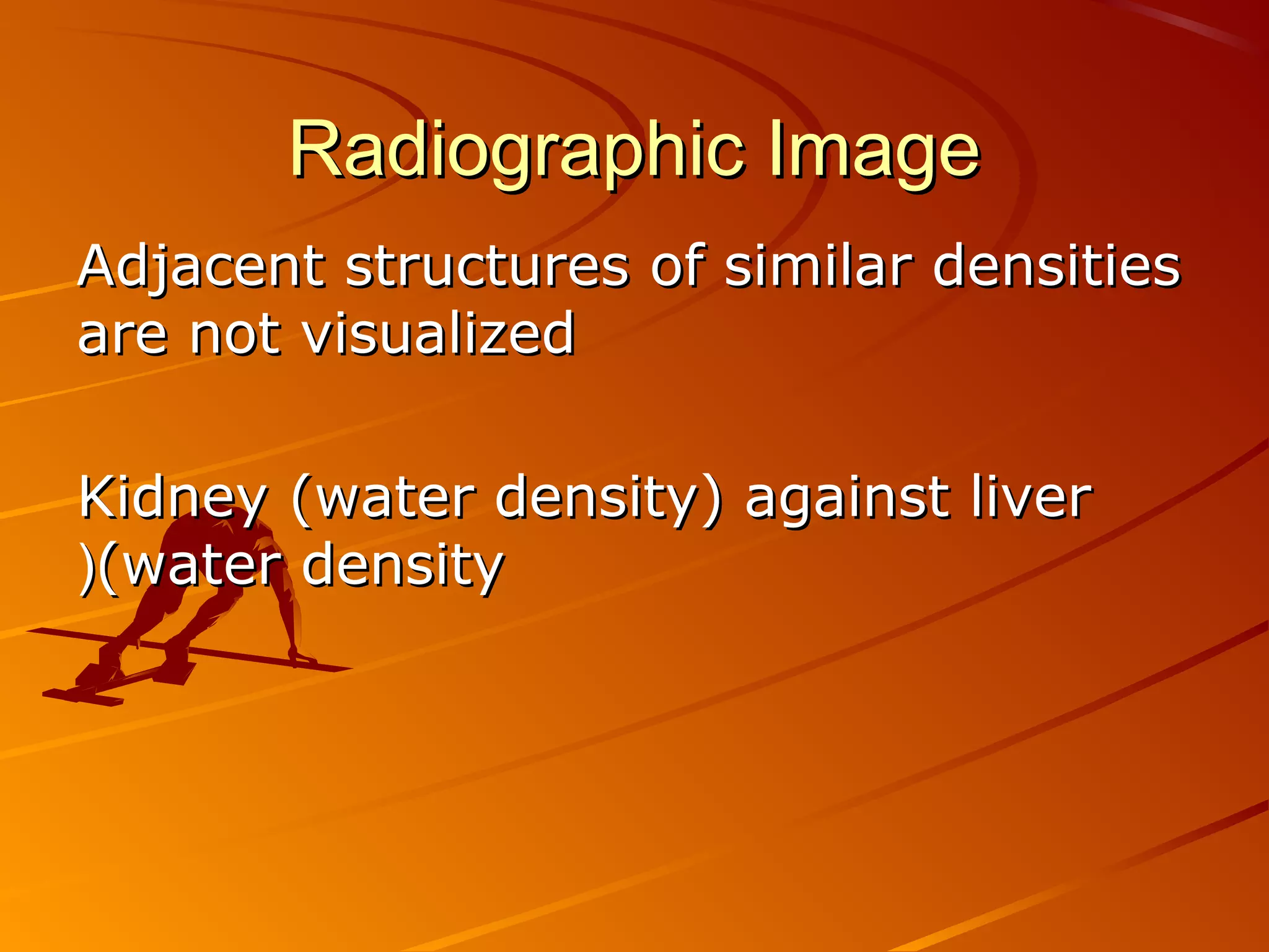 Chest x ray dasic approach 2015 - dr magdi sasi | PPT