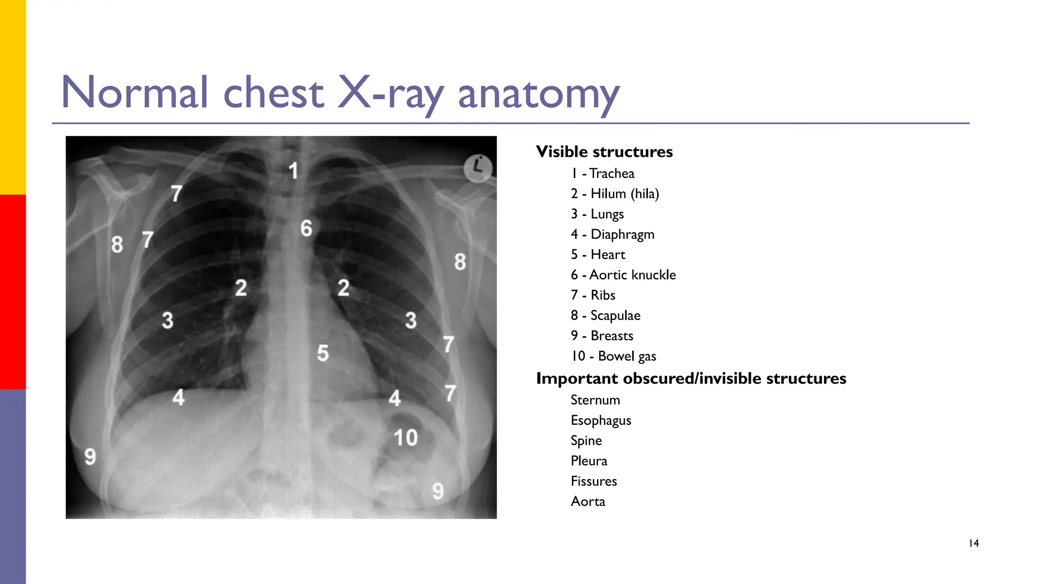 Chest Xray interpretation and normal Abdikadir Hassan .pptx