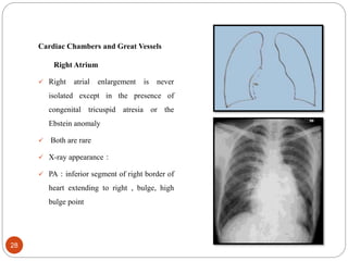 chestxrayforevaluationofcardiovascularsystem-170204135120.pdf