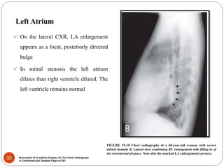 Chest xray for evaluation of cardiovascular system | PPTX