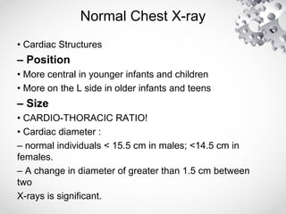 Chest x ray for surgeons | PPT