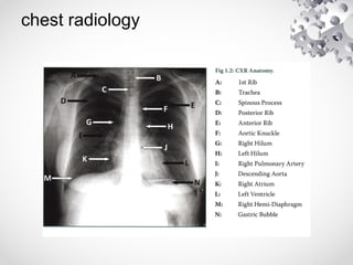 Chest x ray for surgeons | PPT
