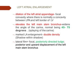 Chest x ray in relation to cardiovascular evaluataion.pptx