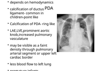 CHEST X RAY IN CONGENITAL HEART DISEASE2.pptx