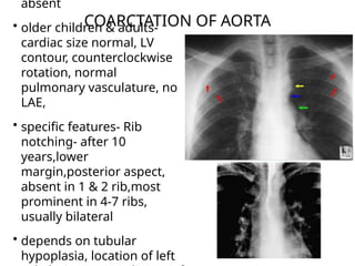 CHEST X RAY IN CONGENITAL HEART DISEASE2.pptx