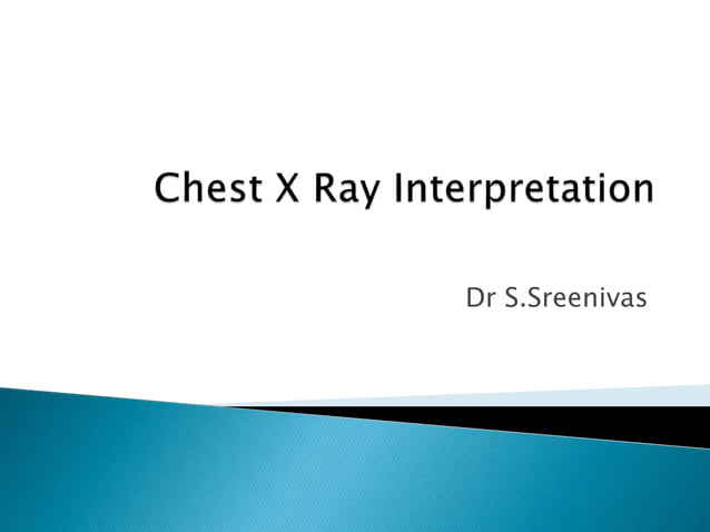 Chest X Ray Interpretation-1.pptx by srinivas | PPTX