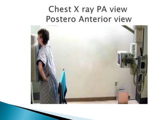 Chest X Ray Interpretation 1 Pptx By Srinivas Pptx