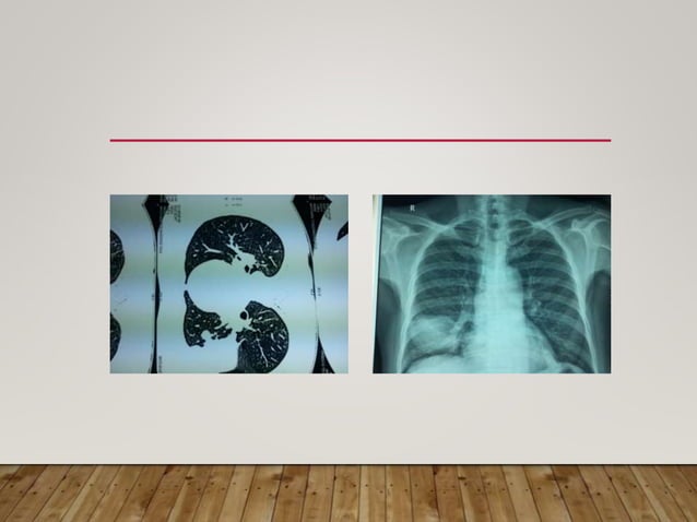 chest x ray interpretation.pptx | Lung and Respiratory Health ...
