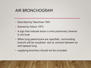 chest x ray interpretation.pptx