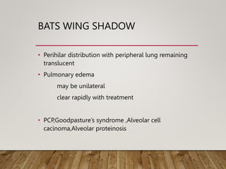 chest x ray interpretation.pptx