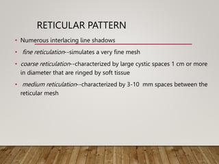 chest x ray interpretation.pptx