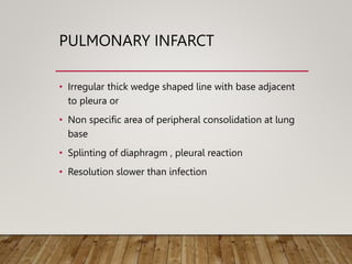 chest x ray interpretation.pptx