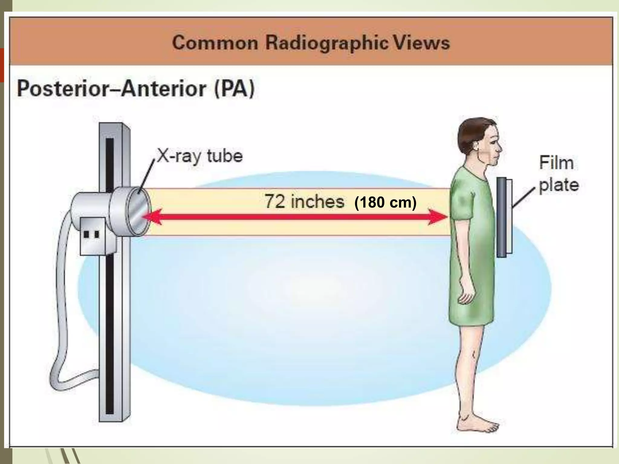Chest Xray - How to read & interpret | PPTX