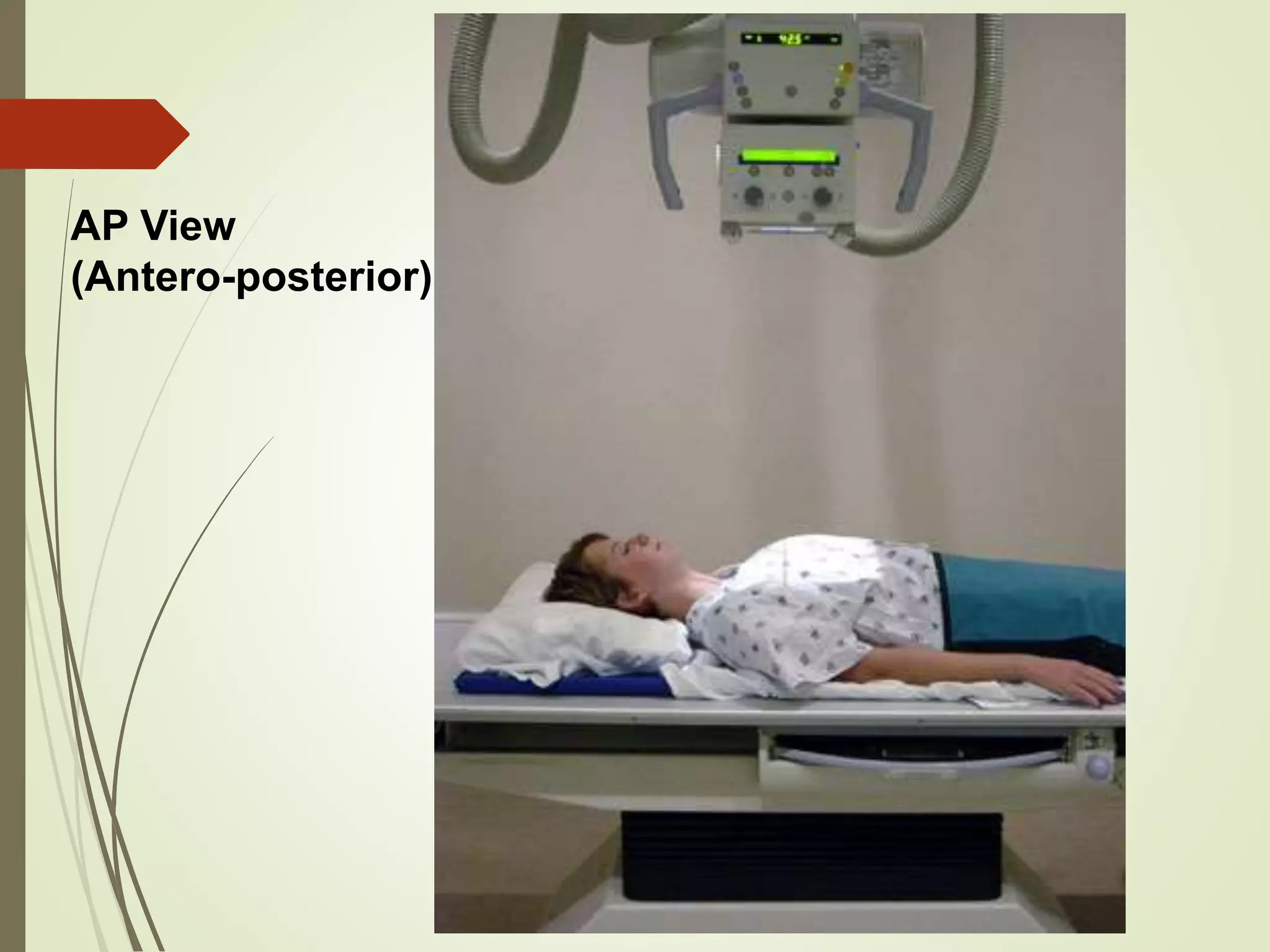 Chest Xray - How to read & interpret | PPTX