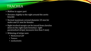 Chest XRAY -anatomy Dr.SALBIA XAVIER K | PPTX